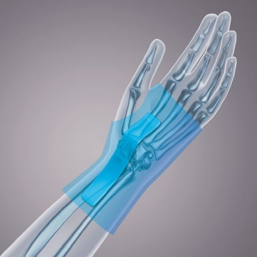 Oppo Health Stabilised Wrist Splint - WristSupports.co.uk